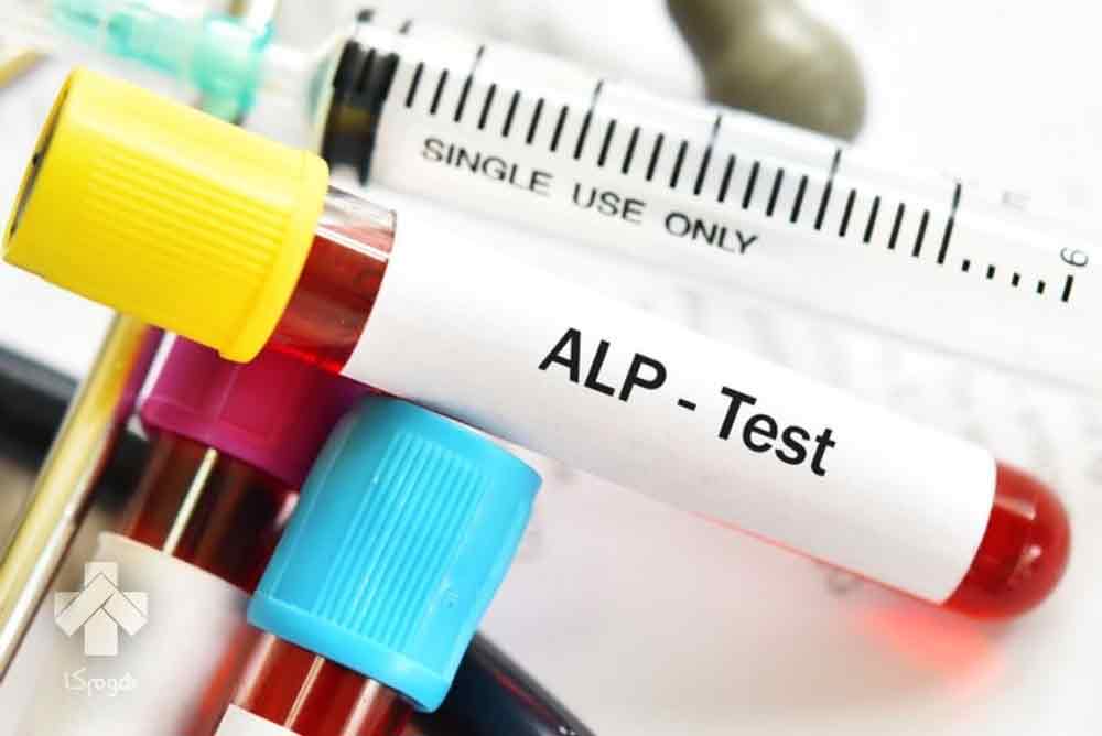 آزمایش ALP - انجام آزمایش در منزل | هوم‌کا