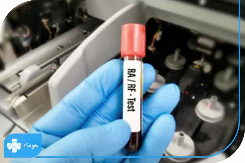 آزمایش RF - RF و RF Titer در آزمایش خون | هومکا