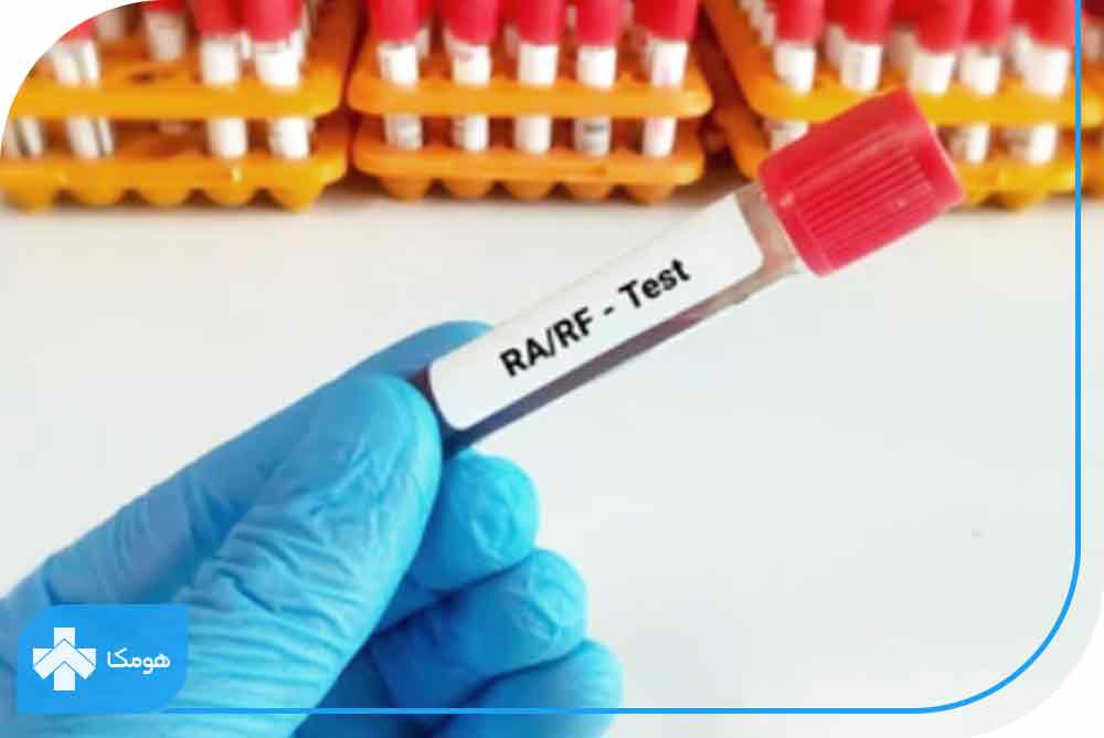 آزمایش RF - RF و RF Titer در آزمایش خون | هومکا
